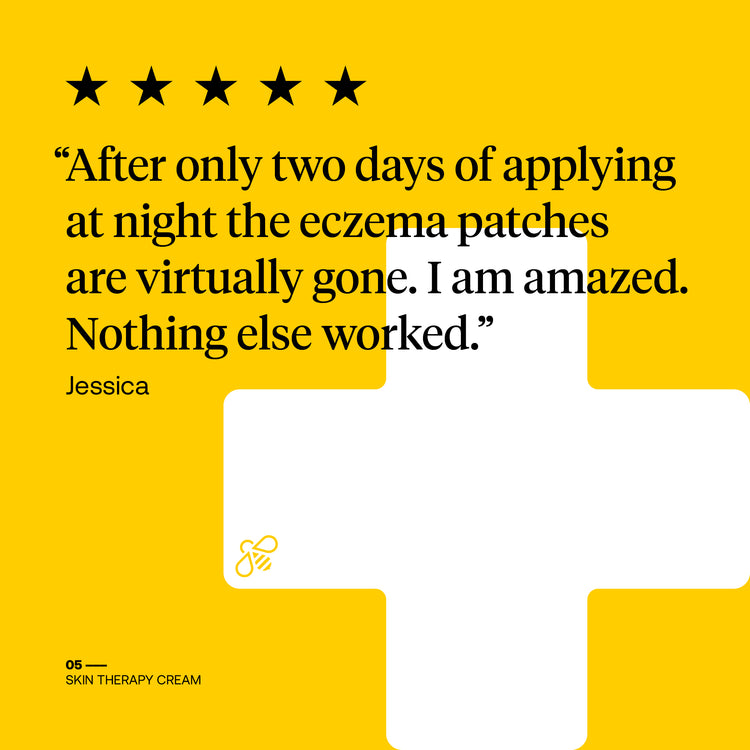 Manuka Honey Eczema Cream | First Honey